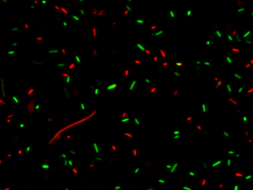 Fluorescence Microscopy Bacteria
