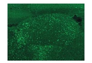 Fluoro-Jade®B | AAT Bioquest