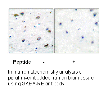 GABA-RB (Ab-434) Antibody | AAT Bioquest