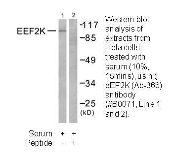 eEF2K (Ab-366) Antibody | AAT Bioquest