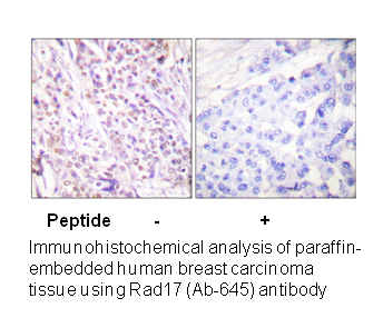 RAD17 (Ab-645) Antibody | AAT Bioquest