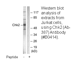 Chk2 (Ab-387) Antibody | AAT Bioquest
