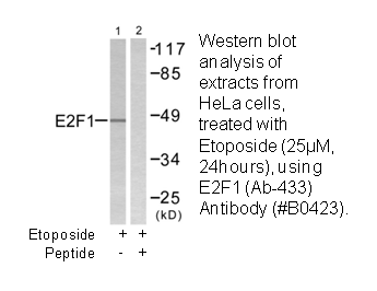 E2F1 (Ab-433) Antibody | AAT Bioquest