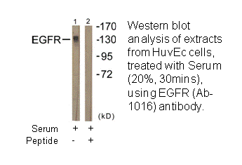 EGFR (Ab-1016) Antibody | AAT Bioquest