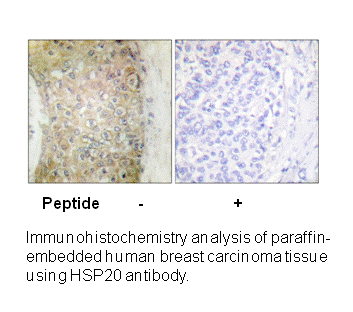 HSP20 (Ab-16) Antibody | AAT Bioquest