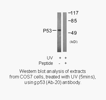 p53 (Ab-20) Antibody | AAT Bioquest