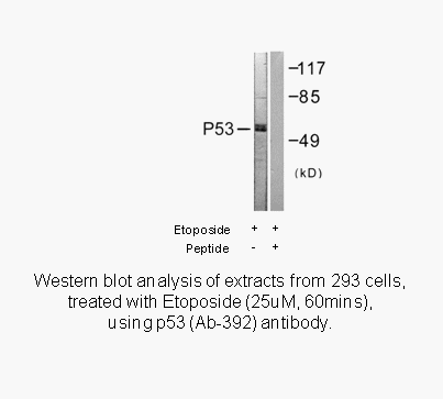 p53 (Ab-392) Antibody | AAT Bioquest