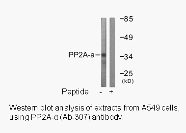 PP2A-α (Ab-307) Antibody | AAT Bioquest