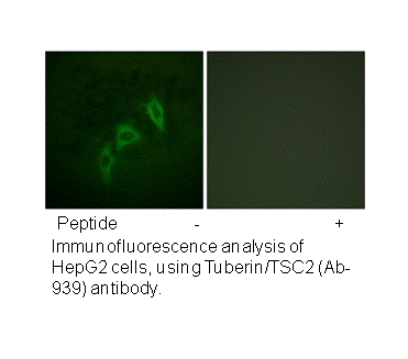 Tuberin/TSC2 (Ab-939) Antibody | AAT Bioquest