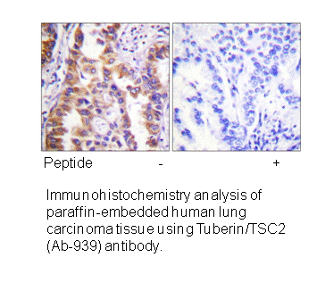 Tuberin/TSC2 (Ab-939) Antibody | AAT Bioquest