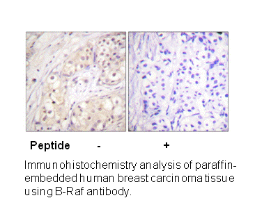 B-RAF (Ab-598) Antibody | AAT Bioquest