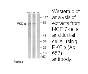 PKC α (Ab-657) Antibody | AAT Bioquest