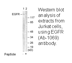 EGFR (Ab-1069) Antibody | AAT Bioquest
