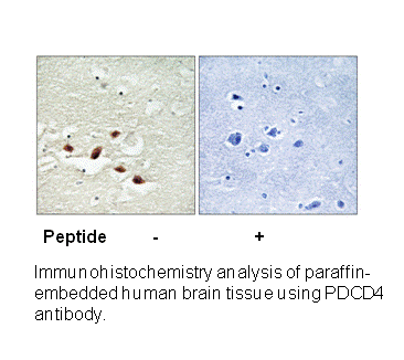 PDCD4 (Ab-67) Antibody | AAT Bioquest