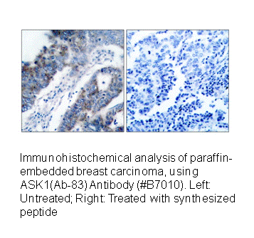 ASK1 (Ab-83) Antibody | AAT Bioquest