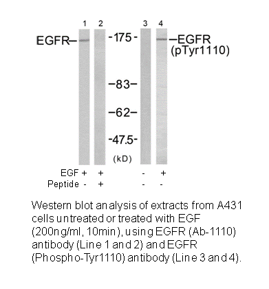 EGFR (Ab-1110) Antibody | AAT Bioquest