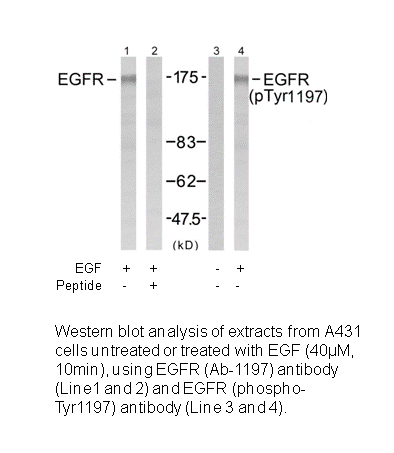 EGFR (Ab-1197) Antibody | AAT Bioquest
