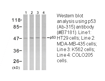 p53 (Ab-315) Antibody | AAT Bioquest