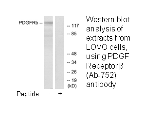 PDGF Receptor β (Ab-752) Antibody | AAT Bioquest