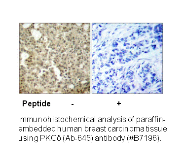PKC δ (Ab-645) Antibody | AAT Bioquest
