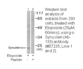 Synuclein-α (Ab-133) Antibody | AAT Bioquest