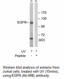 EGFR (Ab-998) Antibody | AAT Bioquest