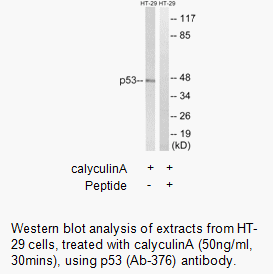 p53 (Ab-376) Antibody | AAT Bioquest