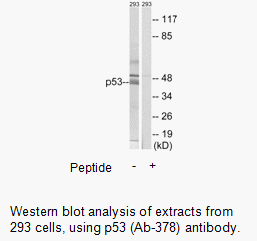 p53 (Ab-378) Antibody | AAT Bioquest