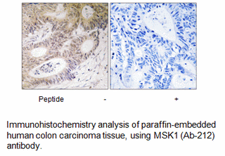 MSK1 (Ab-212) Antibody | AAT Bioquest