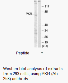 PKR (Ab-258) Antibody | AAT Bioquest