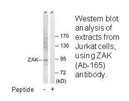 ZAK (Ab-165) Antibody | AAT Bioquest