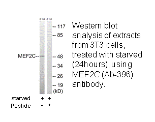 MEF2C (Ab-396) Antibody | AAT Bioquest