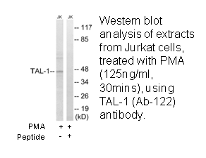 TAL-1 (Ab-122) Antibody | AAT Bioquest