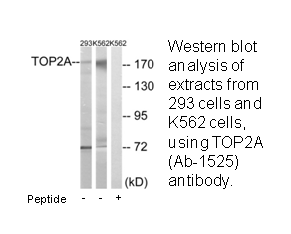 TOP2A (Ab-1525) Antibody | AAT Bioquest