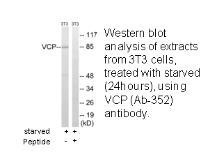 VCP (Ab-352) Antibody | AAT Bioquest