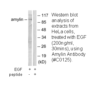 Amylin Antibody | AAT Bioquest