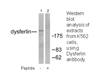 Dysferlin Antibody | AAT Bioquest