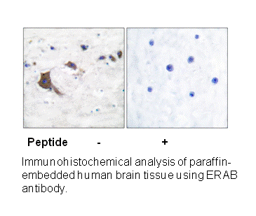 ERAB Antibody | AAT Bioquest
