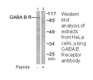 GABA-B Receptor Antibody | AAT Bioquest