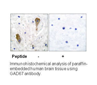 GAD1 Antibody | AAT Bioquest