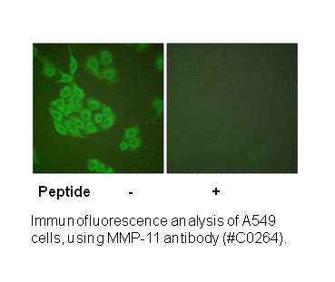 MMP-11 Antibody | AAT Bioquest