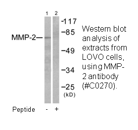 MMP-2 Antibody | AAT Bioquest