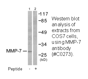 MMP-7 Antibody | AAT Bioquest