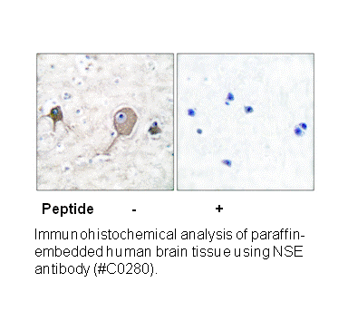 NSE Antibody | AAT Bioquest
