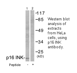 p16 INK Antibody | AAT Bioquest