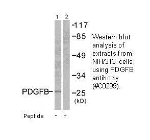 PDGFB Antibody | AAT Bioquest