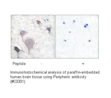 Peripherin Antibody | AAT Bioquest