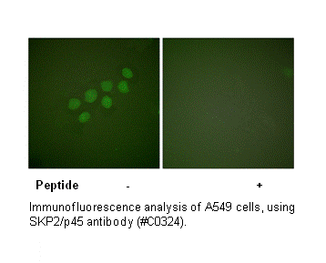 SKP2/p45 Antibody | AAT Bioquest