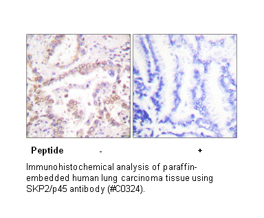 SKP2/p45 Antibody | AAT Bioquest