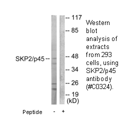 SKP2/p45 Antibody | AAT Bioquest